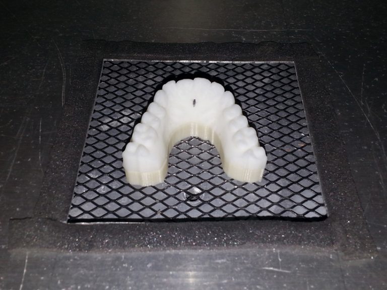designer 3D prints their own plastic braces to fix their teeth