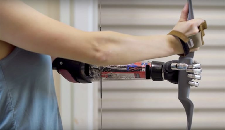 watch how the current state of human bionics is redefining humanity