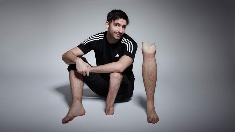 the alternative limb project creates surreal and unreal prosthesis