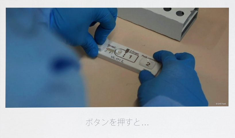 rapid diagnostic kit for tuberculosis wins GOOD DESIGN grand award