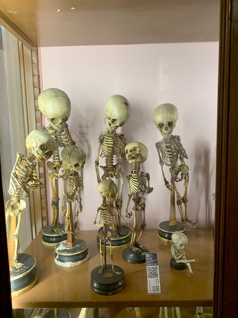 the anatomy museum in naples surveys both normal anatomy and anatomic ...