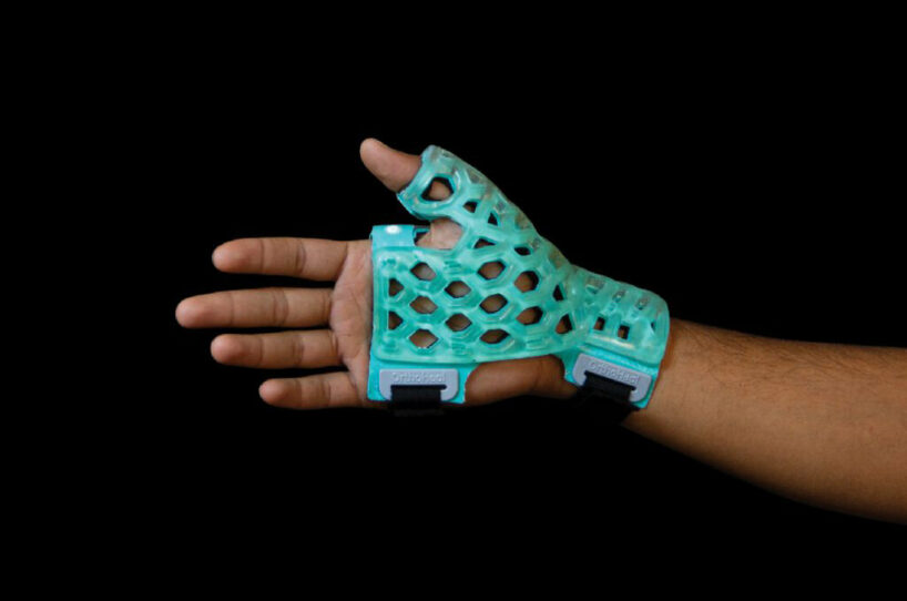 washable & breathable flexiOH cast adapts to the patient's skin