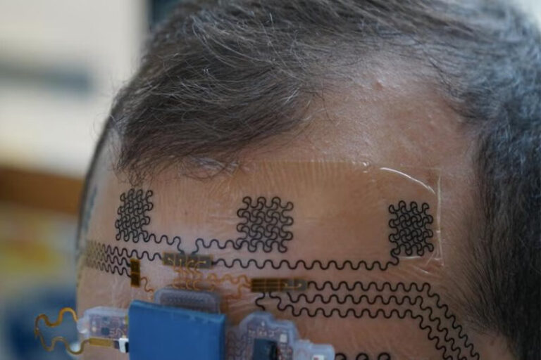 face e-tattoo uses skin-like sensors to detect mental stress
